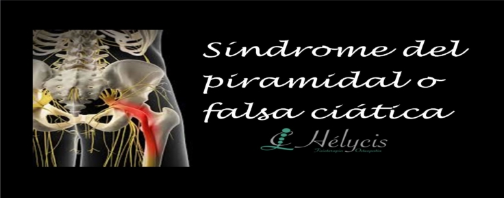 Síndrome del piramidal o falsa ciática. ¿Cómo solucionarlo?